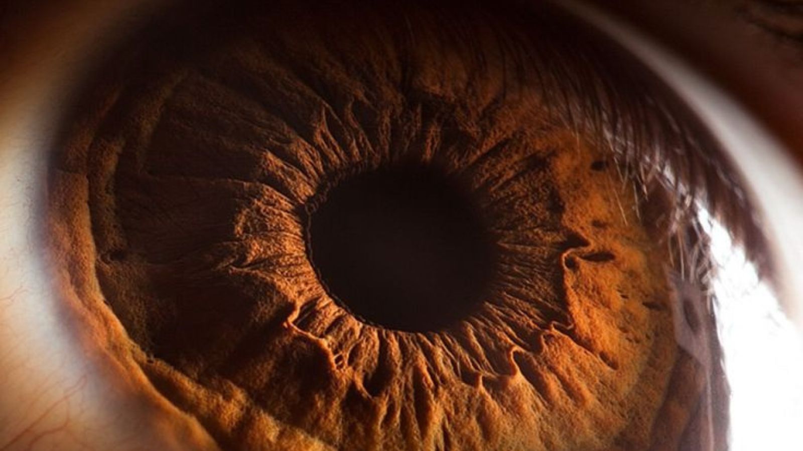 Anisocoria: Unequal Pupils, Untangling the Causes and Concerns